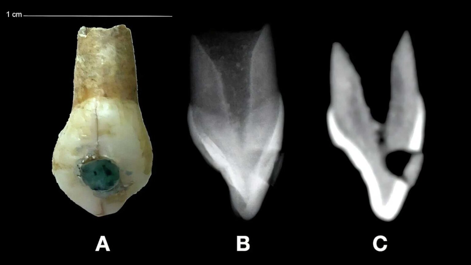 7-Year-Old Maya Child Wore Jade "Tooth Gem" in Ancient Ritual Practice ...